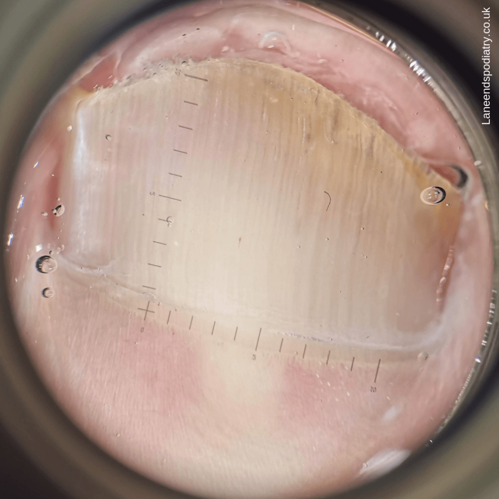 Potty Purple Pod and the Fungus Fight! – Potty Purple Pod